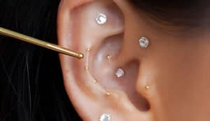 Ear Seeding: What It Is, How It Works, and What It Treats - Kim Nichols MD