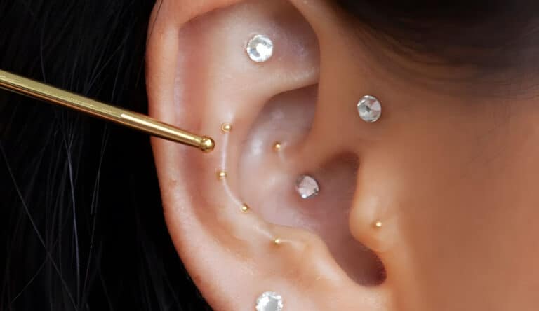 Ear Seeding: What It Is, How It Works, and What It Treats - Kim Nichols MD